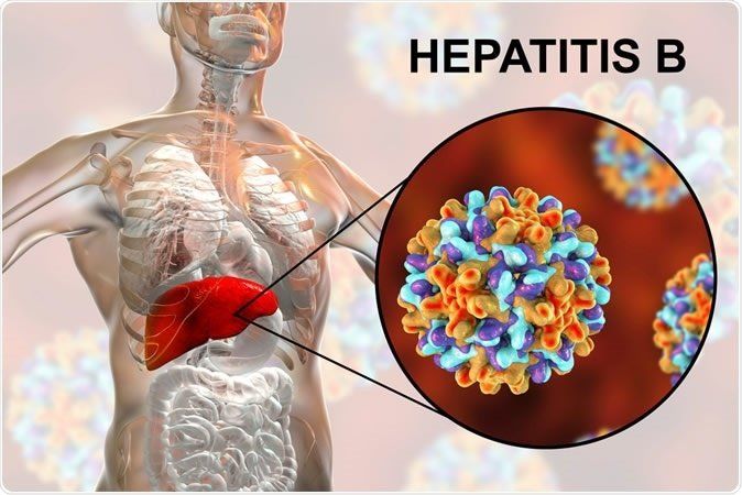 Hepatitis B: 250 millones de infectados y 680 mil muertes por año