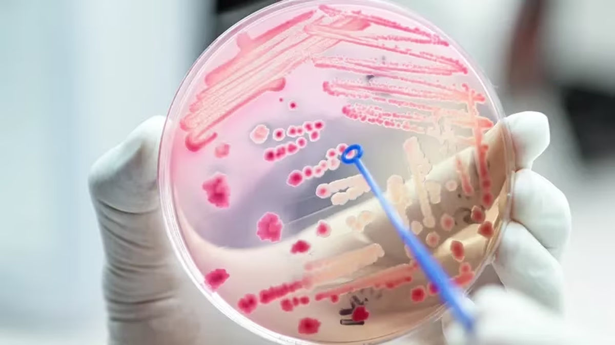 Bacteria Streptococcus Pyogenes: ¿Cuáles son los síntomas?