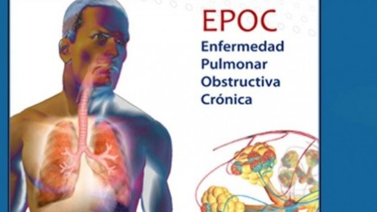 Cambios en el tratamiento de las personas con EPOC