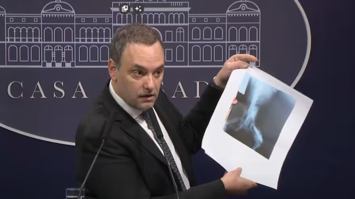 Advierten de una operación de Adorni sobre las pensiones por discapacidad