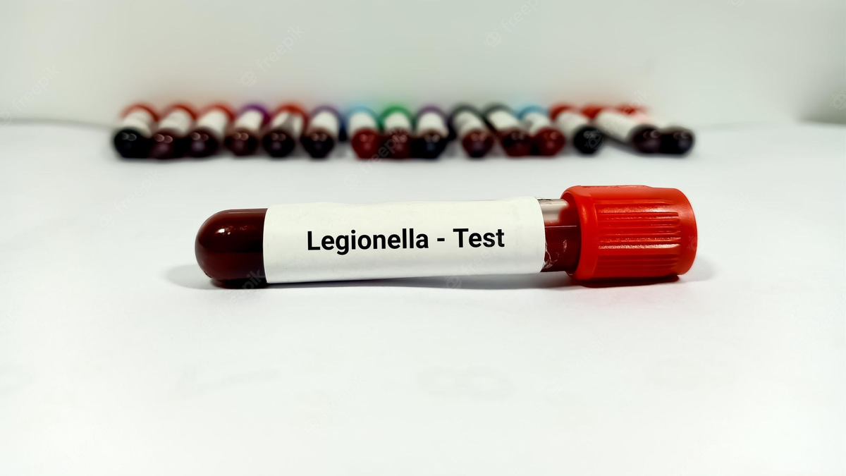 Legionella: Salud informó sobre la situación epidemiológica