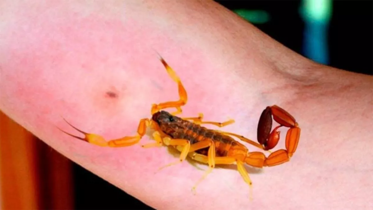 Recomendaciones ante la aparición o picadura de alacranes