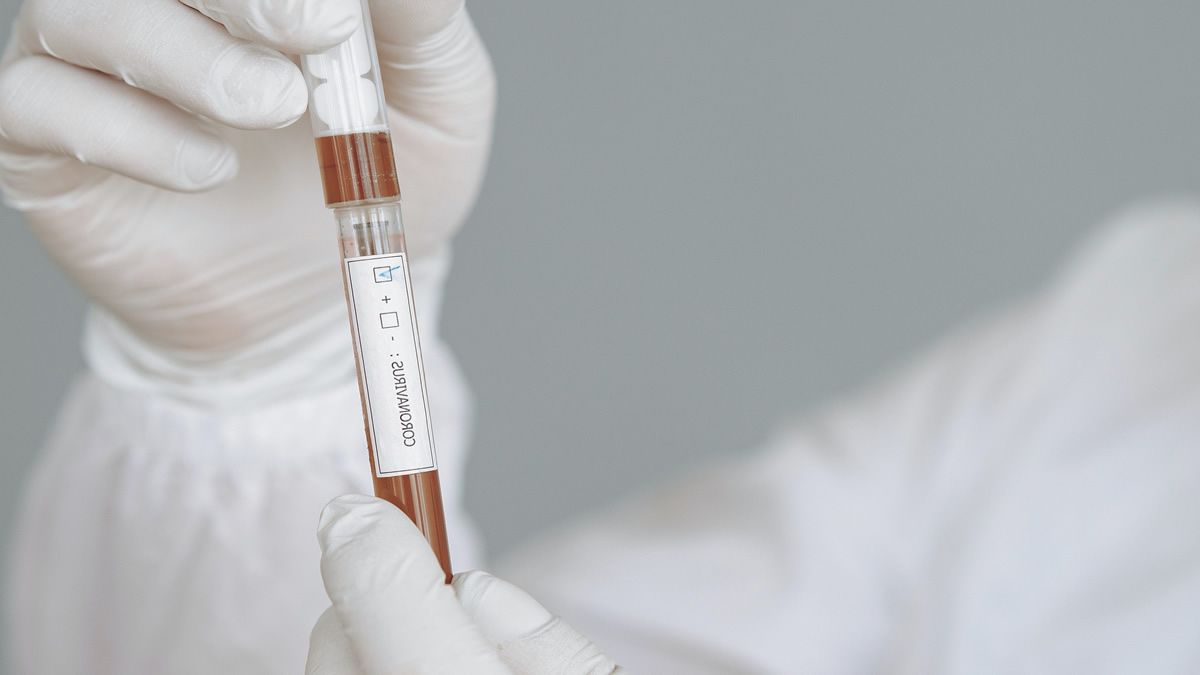 Coronavirus: ¿Cómo funcionan y en qué se diferencian los testeos?